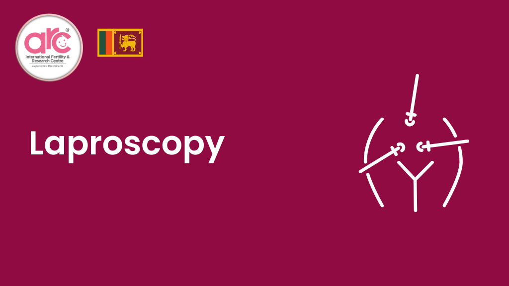 Laproscopy - Know About Process, Benefits & FAQs at ARC