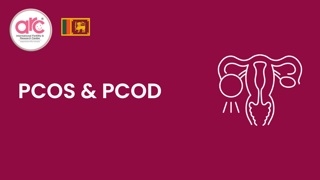 PCOS/PCOD Treatment - ARC Fertility Centre Colombo